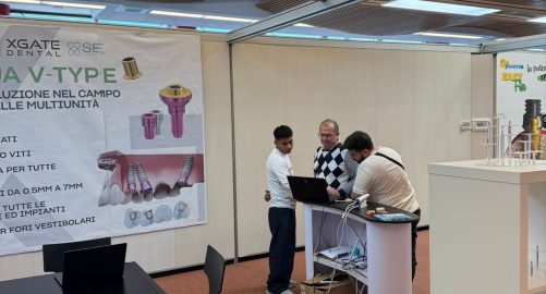 XGATE Dental V-Type MUA System Showcased at Tecnodental 2025